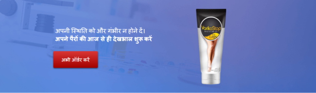 VarikoStop - Cream For Legs in India 50% Discount Price? Order Now
